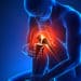 Tyler Welch, MD - Atlantic Orthopaedics & Sports Medicine